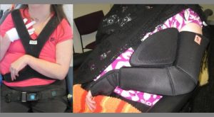 Dynamic Arm Splints | Second Skin AU/NZ